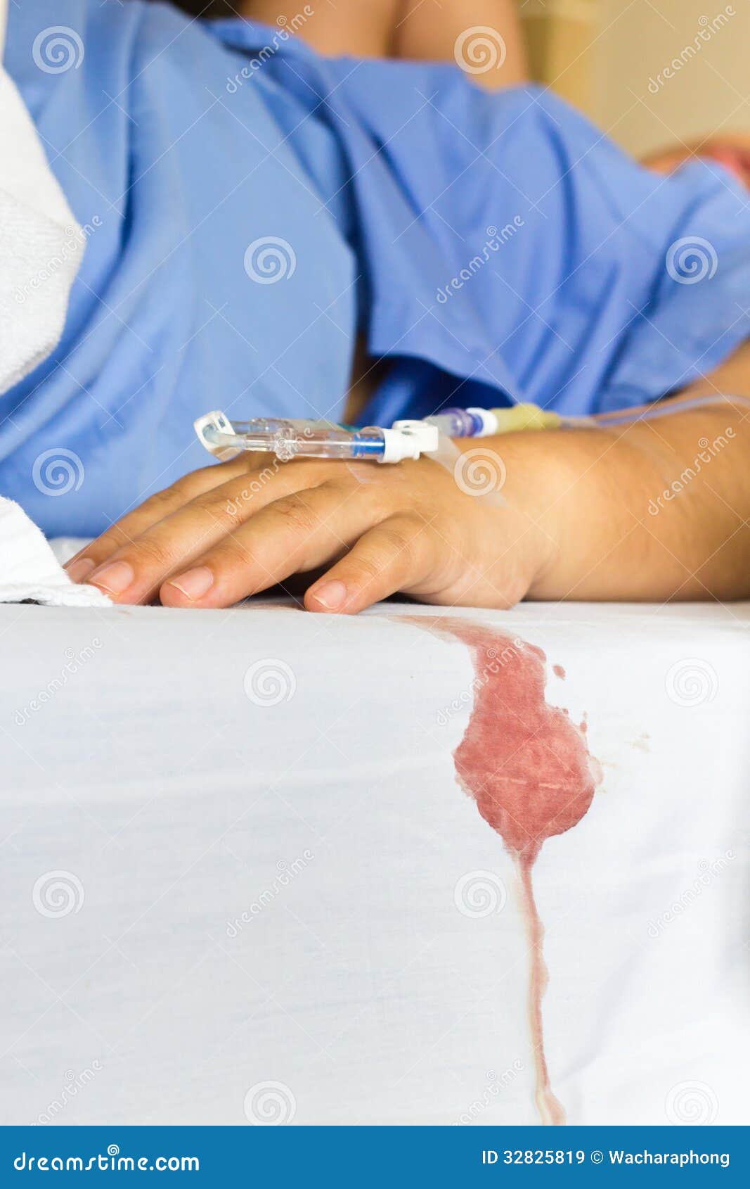 A Hand Patient With An Intravenous Drip Royalty Free Stock Images ... A Hand Patient With An Intravenous Drip Royalty Free Stock Images ...