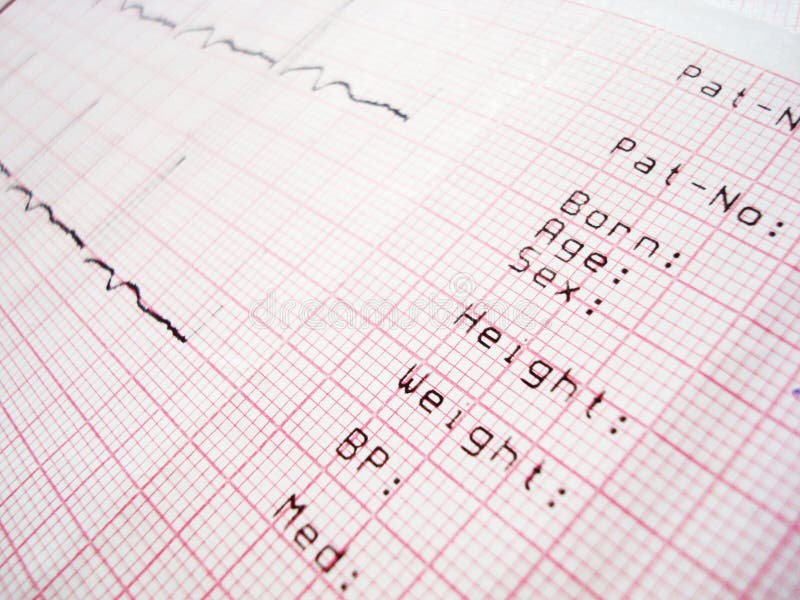 Électrocardiographie d'ECG image stock. Image du papier - 14882381