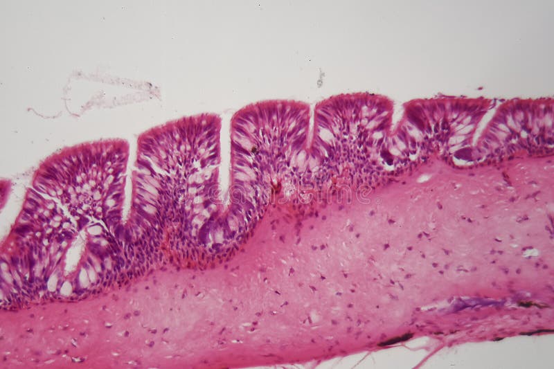 Bord Ciliated De L'épithélium 400x De Cellule Avec Des Cils Photo stock ...
