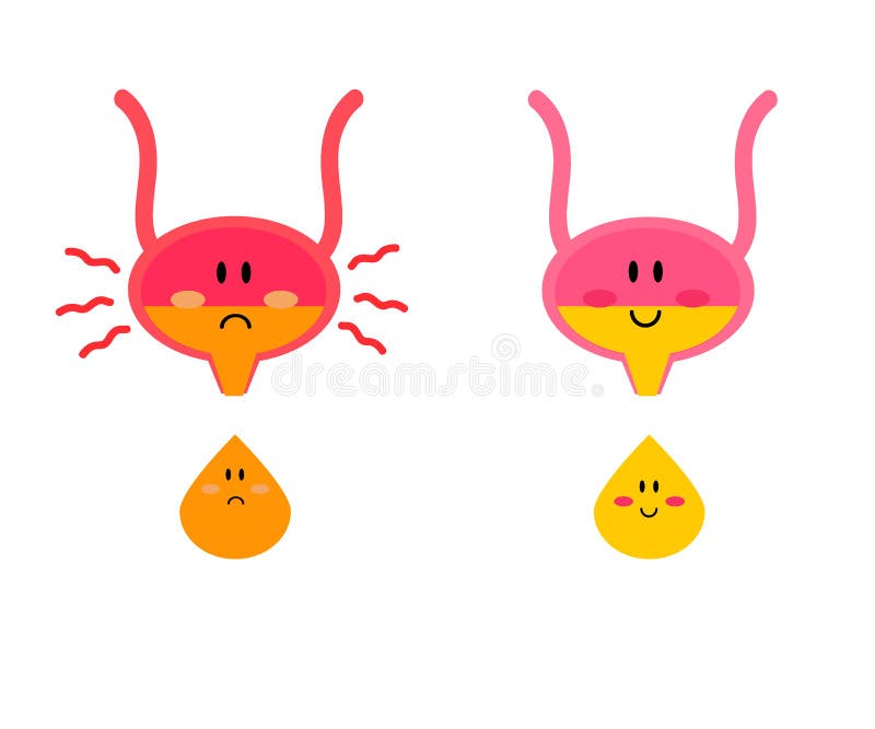 Cystitis. Inflammation of the Bladder. the Structure of the Kidneys and ...