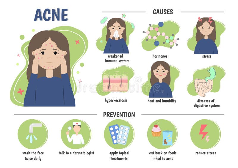 Medical infographics acne stock vector. Illustration of hygiene - 178034024