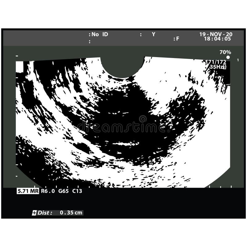 Abstract Image from the Monitor Screen of Ultrasonic Equipment Stock ...