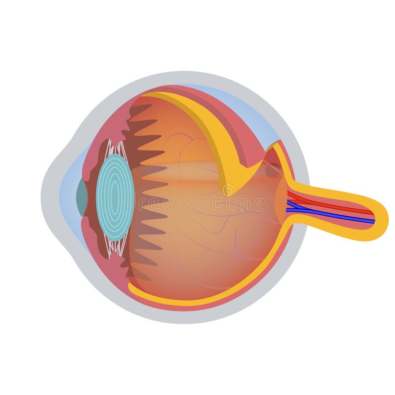 Eye Cancer, Malignant Formation at the Bottom. Stock Vector ...