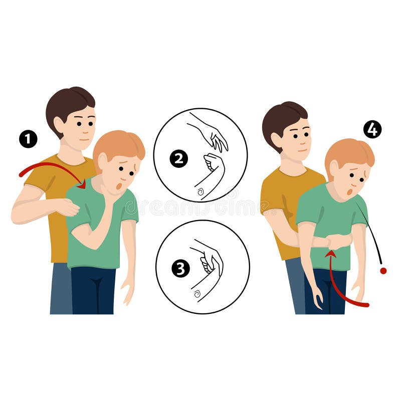 Heimlich Maneuver Adult Stock Illustrations – 25 Heimlich Maneuver ...