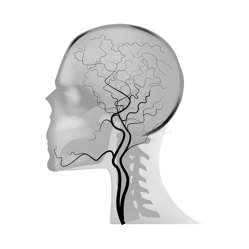 Mr Angiography Cerebral Vessels Stock Illustrations – 1 Mr Angiography ...