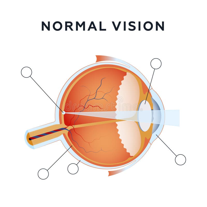 Normal Eye Vision. Modern Flat Vector Illustration. Detailed Anatomy of ...