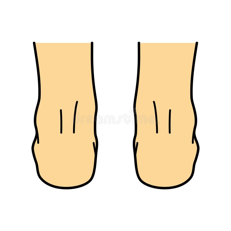 Bare Foot, Heel, Back View, Illustration Stock Image - Illustration of ...