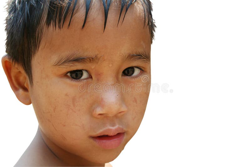 Fattig Ung Pojke Som Ser Kameran Redaktionell Arkivfoto - Bild av ...