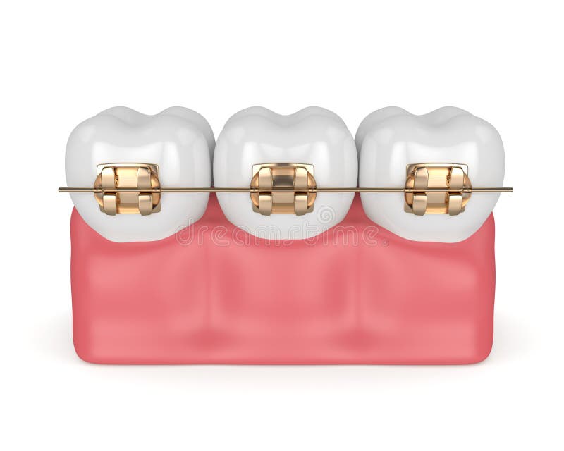 Teeth Arch Stock Illustrations – 171 Teeth Arch Stock Illustrations ...