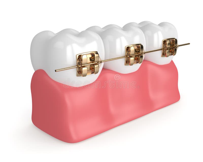 Teeth Arch Stock Illustrations – 171 Teeth Arch Stock Illustrations ...