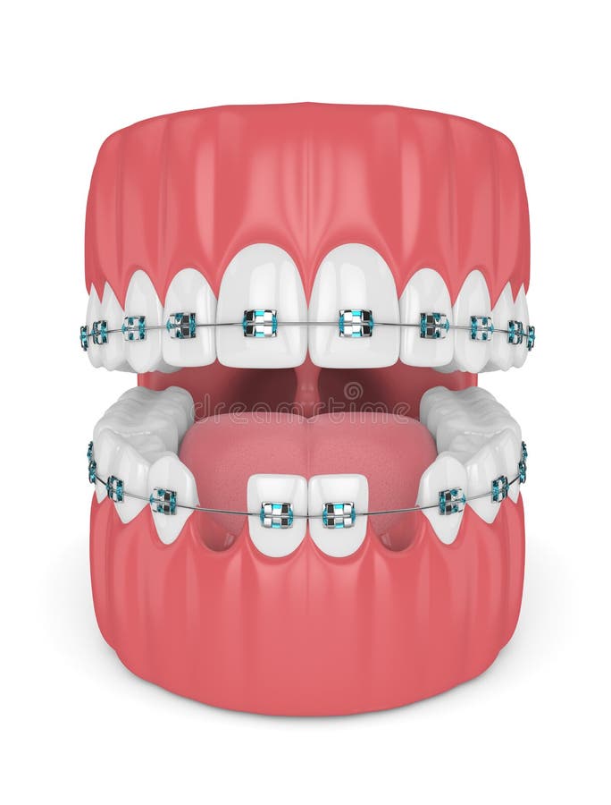Teeth Arch Stock Illustrations – 171 Teeth Arch Stock Illustrations ...