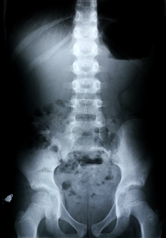 Abdomen adulte photo stock. Image of abdomen, durée, poumon - 196844