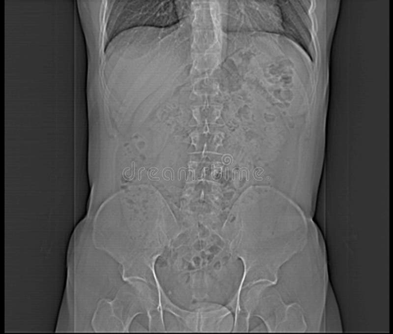 Abdomen human, man stock photo. Image of pelvis, xray - 192990706