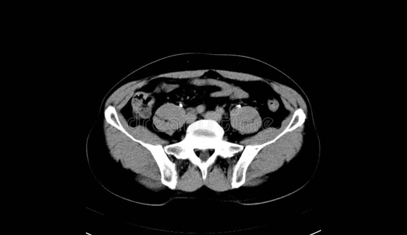 Abdomen human, man stock image. Image of scan, cage - 192990737