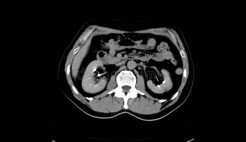 Abdomen human, man stock photo. Image of tissues, diagnosis - 192990738