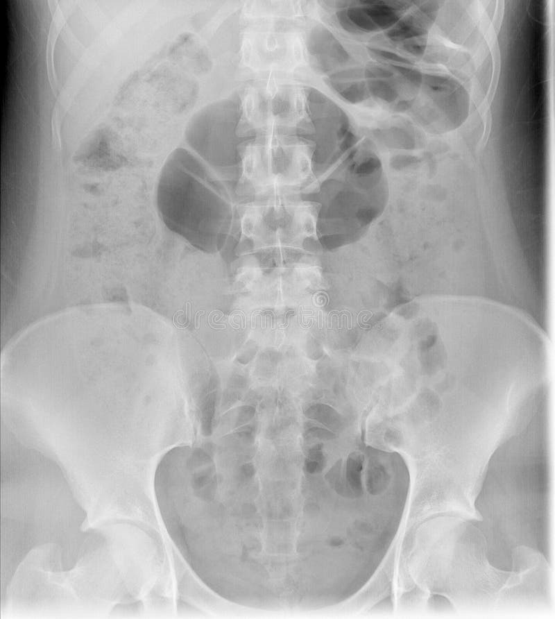 Normal Internal Rotation Hip Stock Photos - Free & Royalty-Free Stock ...