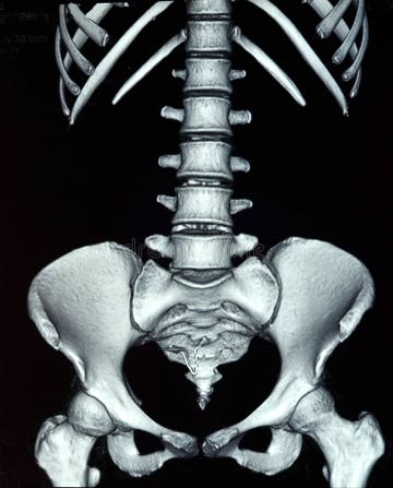 Abdominal Ct Scan Stock Illustrations – 88 Abdominal Ct Scan Stock ...