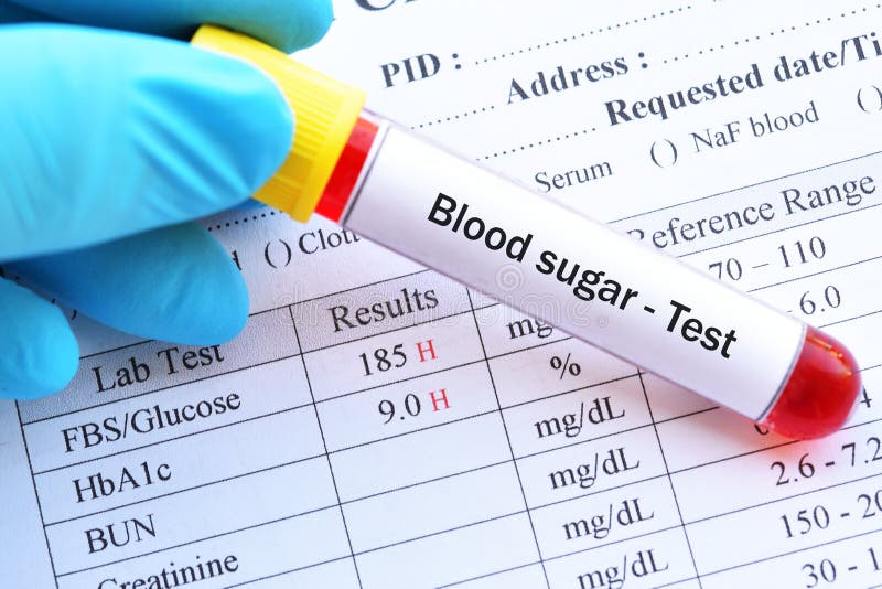 Abnormal Blood Sugar Test Results Stock Image - Image of normal ...