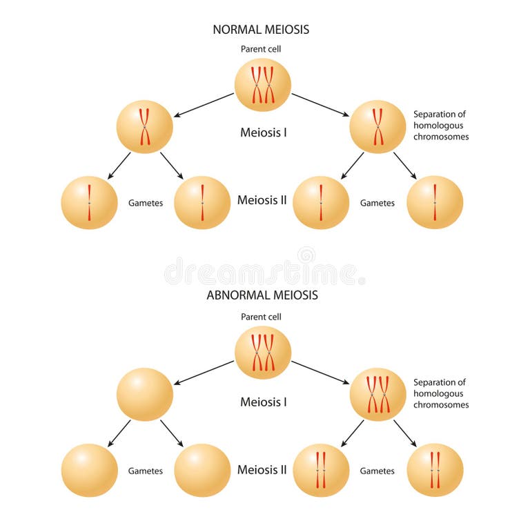 Abnormal Meiosis Stock Illustrations – 7 Abnormal Meiosis Stock ... Abnormal Meiosis Stock Illustrations – 7 Abnormal Meiosis Stock ...