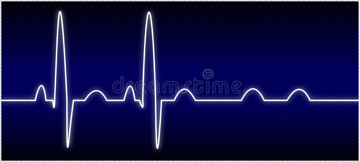 Abnormal Stock Illustrations – 12,727 Abnormal Stock Illustrations ...