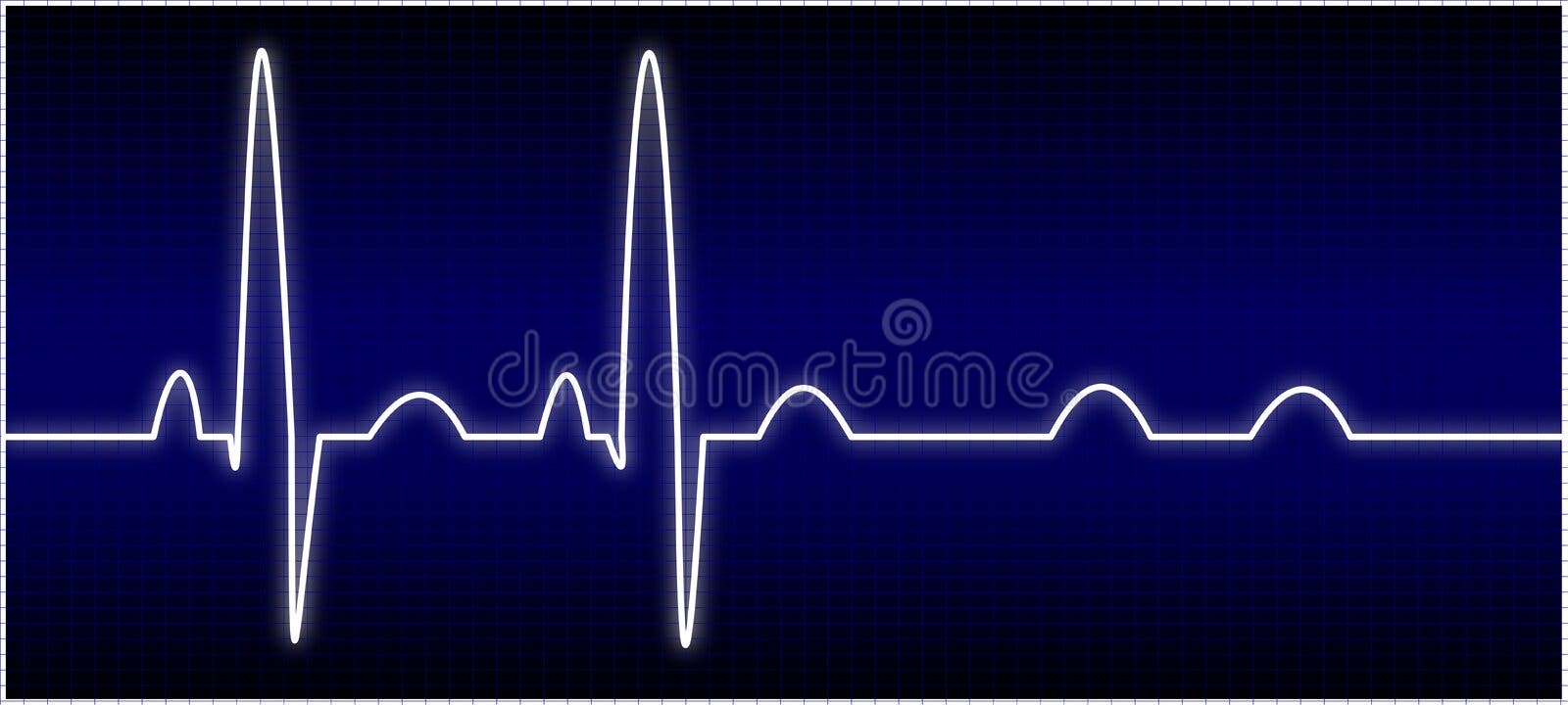 Ecg. Sinusoidal Pulse Lines, Frequency Heartbeat Stress Testing Life ...