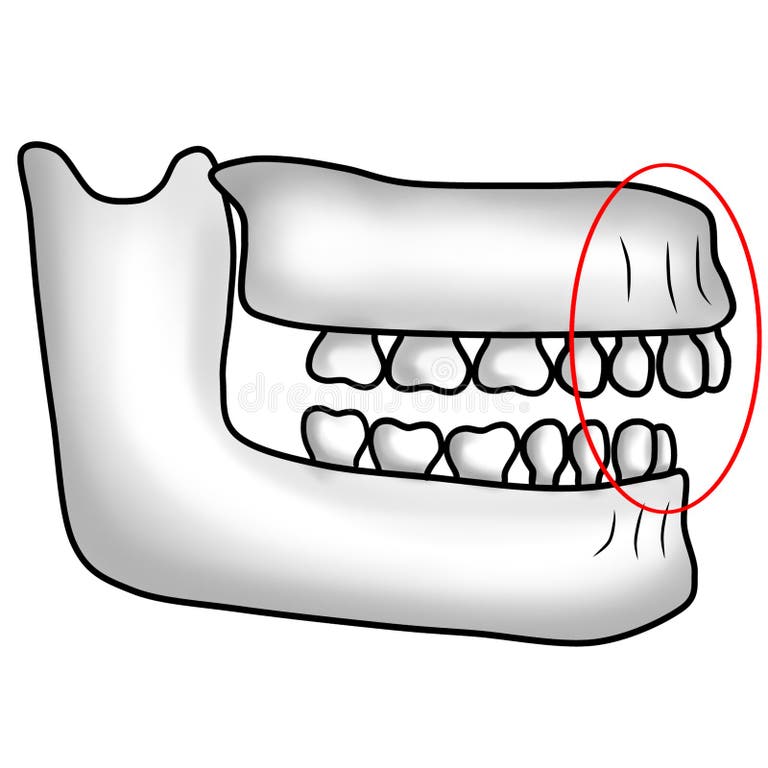 Protruding Stock Illustrations – 11,507 Protruding Stock Illustrations ...
