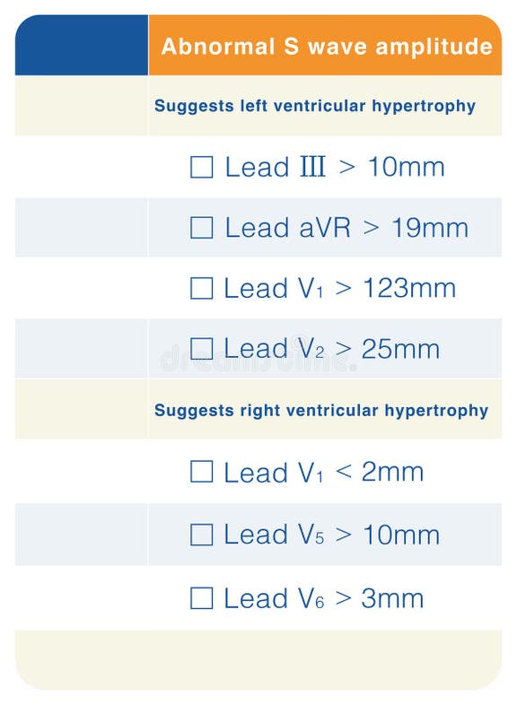 Abnormal S wave amplitude stock image. Image of depolarization - 370621059