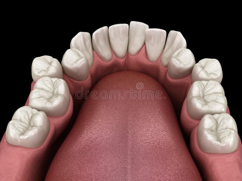 Abnormal Teeth Position, Orthodontic Concept. Medically Accurate Tooth ...