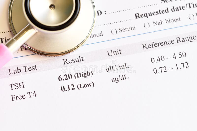 Abnormal Thyroid Hormone Test Result Stock Photo - Image of goiter ...