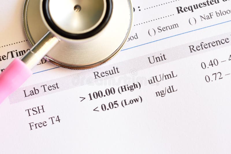 Abnormal Thyroid Hormone Test Result Stock Image - Image of metabolism ...