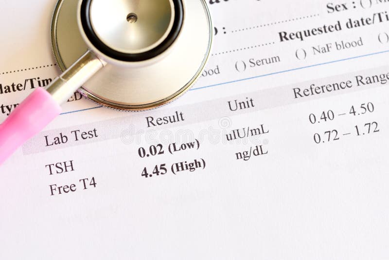 Abnormal Thyroid Hormone Test Result with Stethoscope Stock Image ...