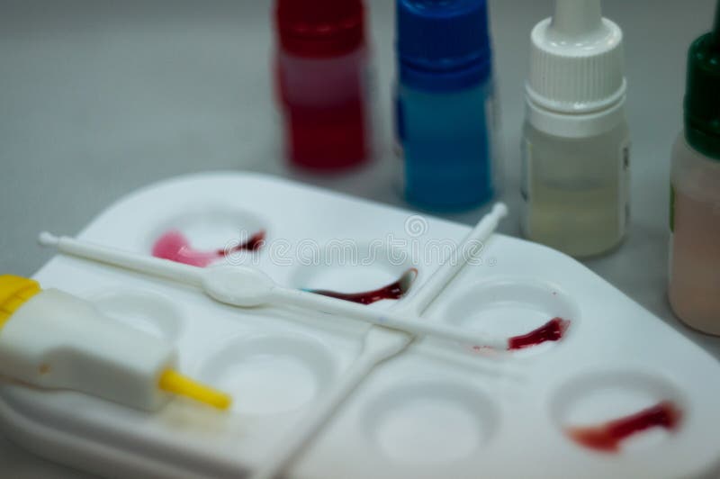 ABO Blood Grouping by Slide Test Techinque Stock Image - Image of blue ...