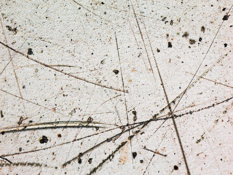 Champignon Dermatophyte Sous Le Microscope Image stock - Image du ...