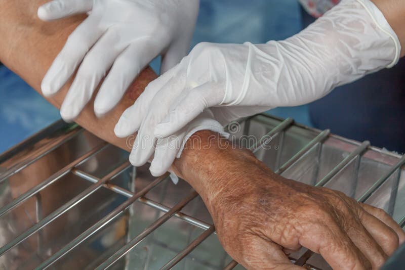 Abrasion wound arm stock photo. Image of background - 100611210