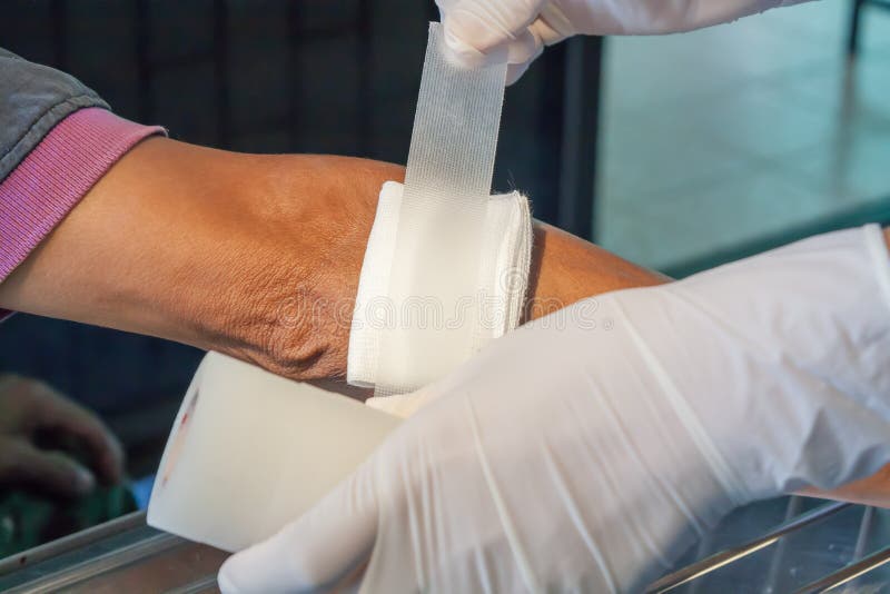 Abrasion wound arm injury stock photo. Image of pain - 99011694