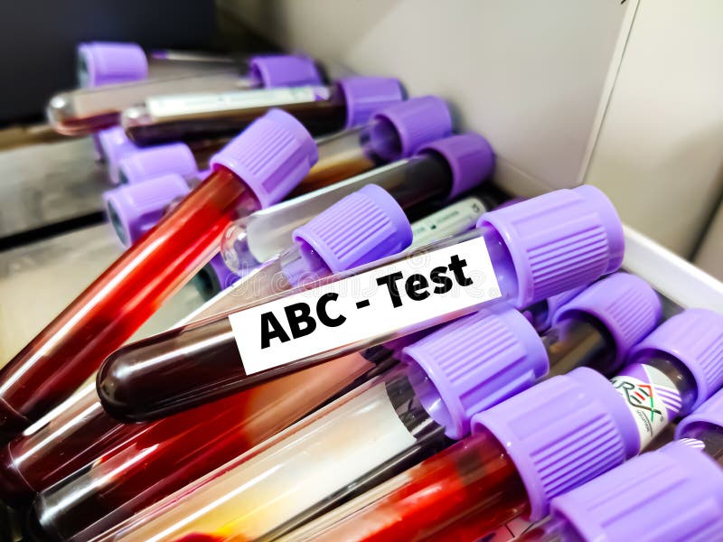 Blood Sample for an Absolute Basophil Count Test Measures the Number of ...