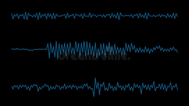Abstract Animation of Pulse Line. Design Element for User Interface ...