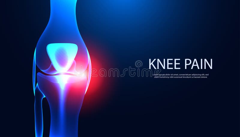 Abstract Bone, Knee Part Anatomy X-ray Model Showing Knee Injury with ...
