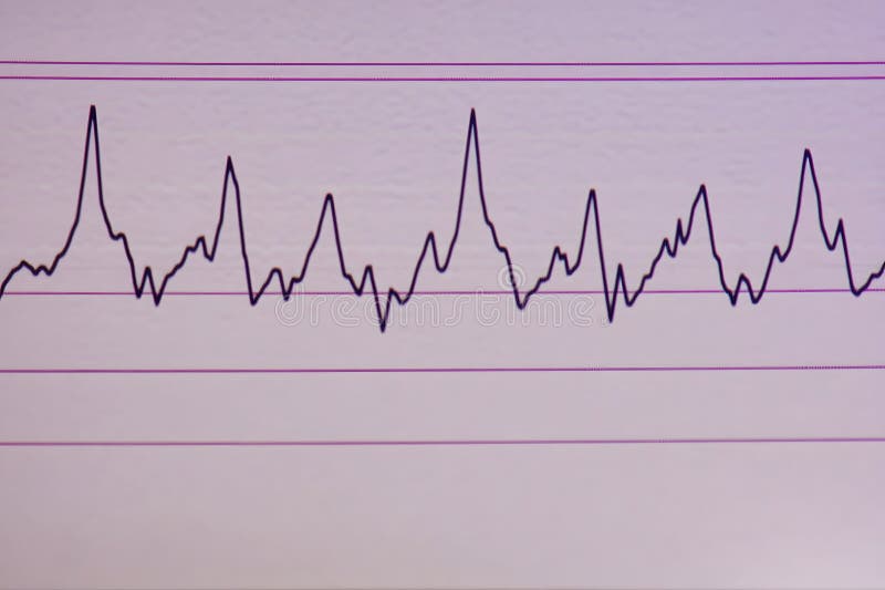 Abstract Data Waveform Chart Stock Image Royalty Free Image Stock ...