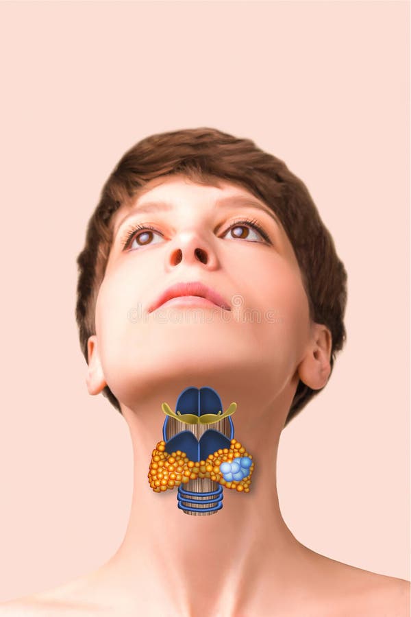Abstract Female With Enlarged Thyroid Gland Structure Stock Image Image Of Endocrinologist