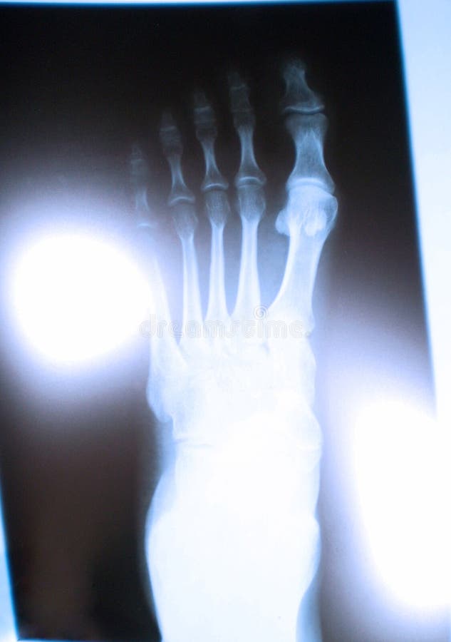 Abstract foot X ray stock image. Image of people, display - 14980277