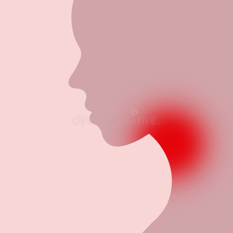 Abstract Illustration of Sore Throat Stock Illustration - Illustration ...