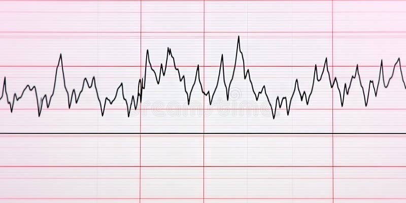 Abstract Irregular Line Graph Data Chart Stock Stock Photo Stock ...