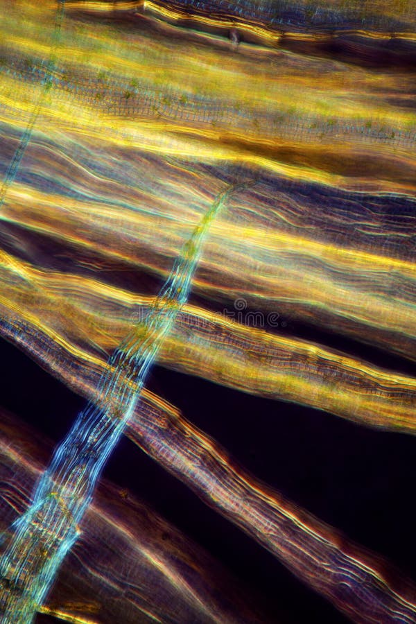 Abstract Micrograph of Peat Moss Leaves, with Polarization Stock Photo ...