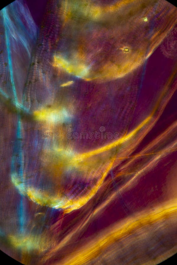 Abstract Micrograph of Peat Moss Leaves, with Polarization Stock Photo ...