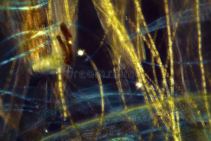 Abstract Micrograph of Peat Moss Leaves, with Polarization Stock Image ...