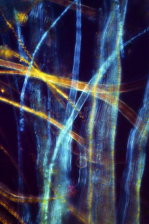 Abstract Micrograph of Peat Moss Leaves, with Polarization Stock Image ...