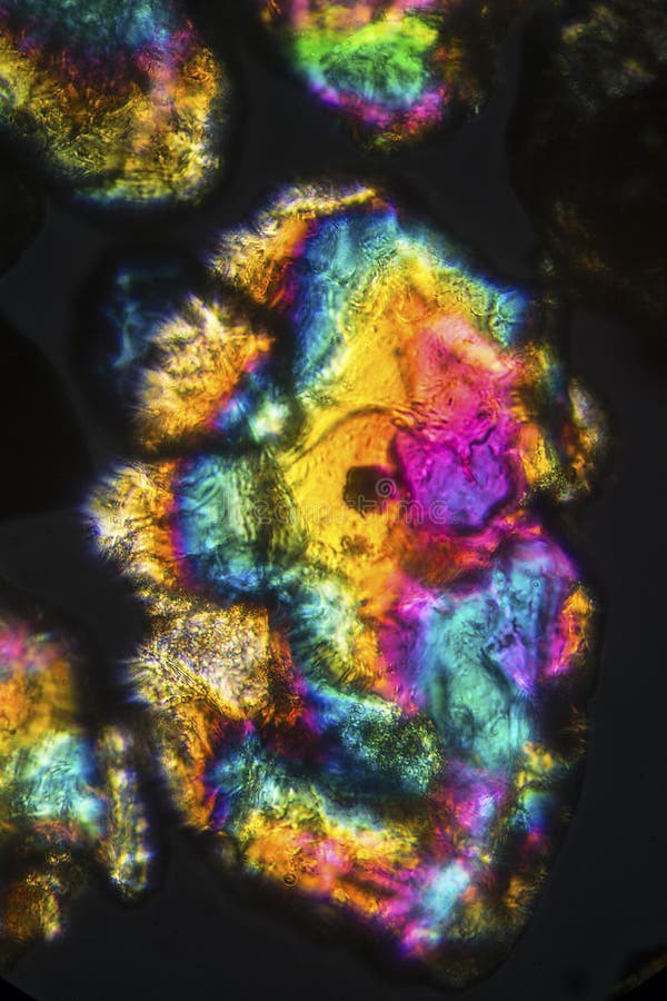 Abstract Micrograph of Sand Grains from Lake Victoria in Africa Stock ...