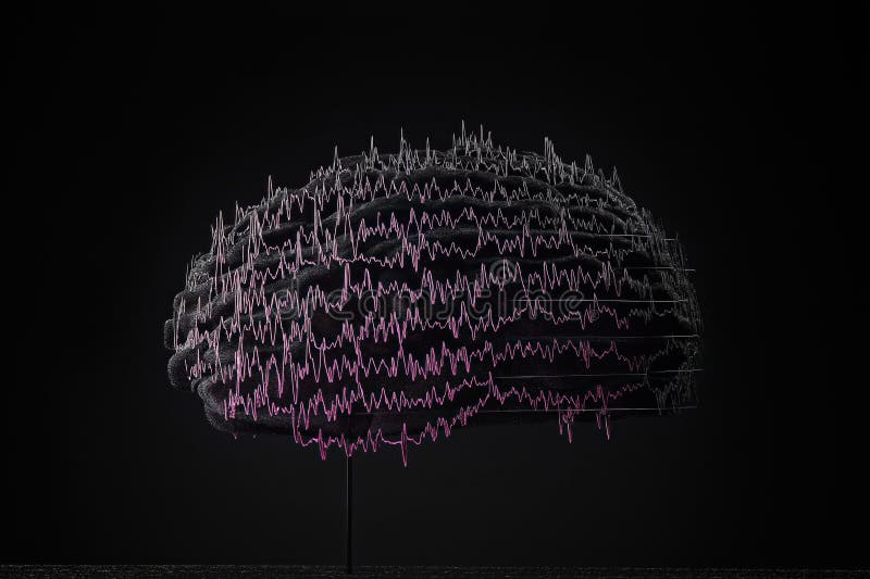 Abstract Representation of Brainwave Activity. Complex Network of Pink ...