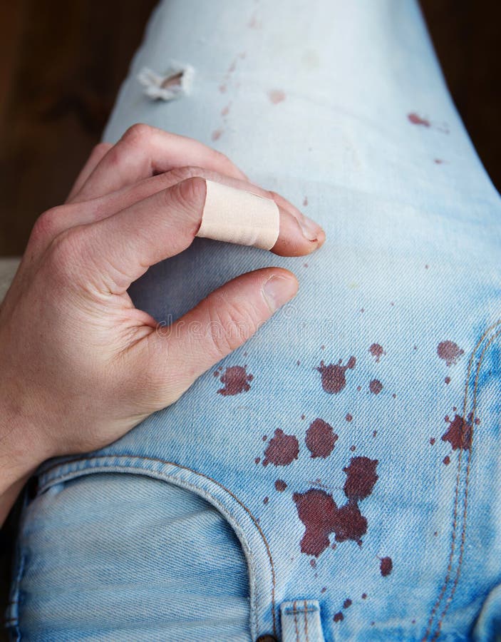 Accident on fabric stock image. Image of injury, bandaged - 83732921
